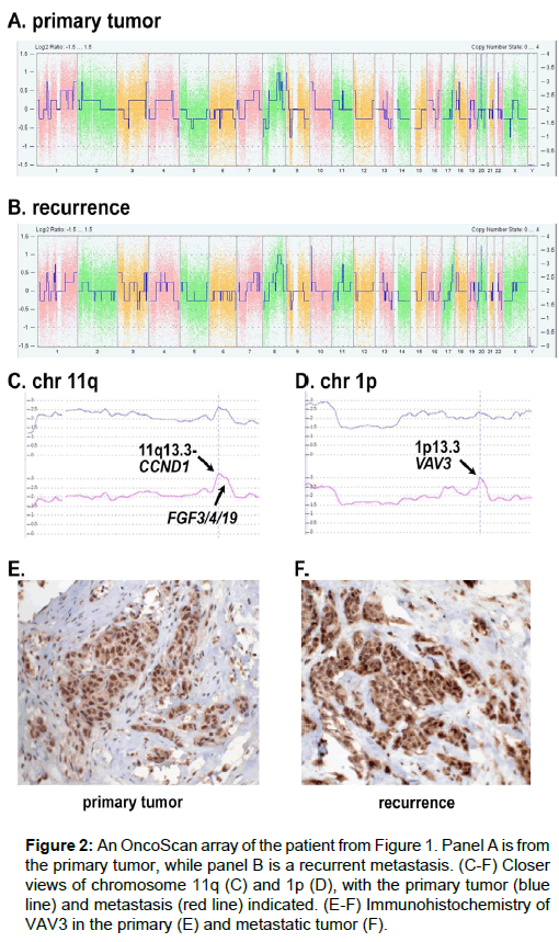 A Case Study of Precision Medicine: Next Generation Sequencing Compared ...
